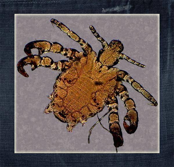 Piattola o Pidocchio del pube - Pthirus pubis